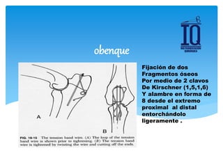 Ortopedia generalidades | PPTX