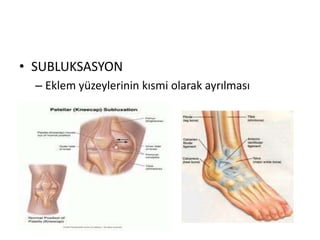 Ortopedik travmalar mehmet tatli | PPTX