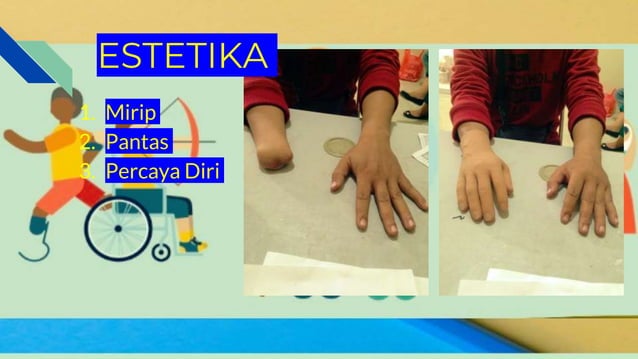 PERAN ORTOTIS PROSTETIS PADA PENYANDANG DISABILITAS | PPTX