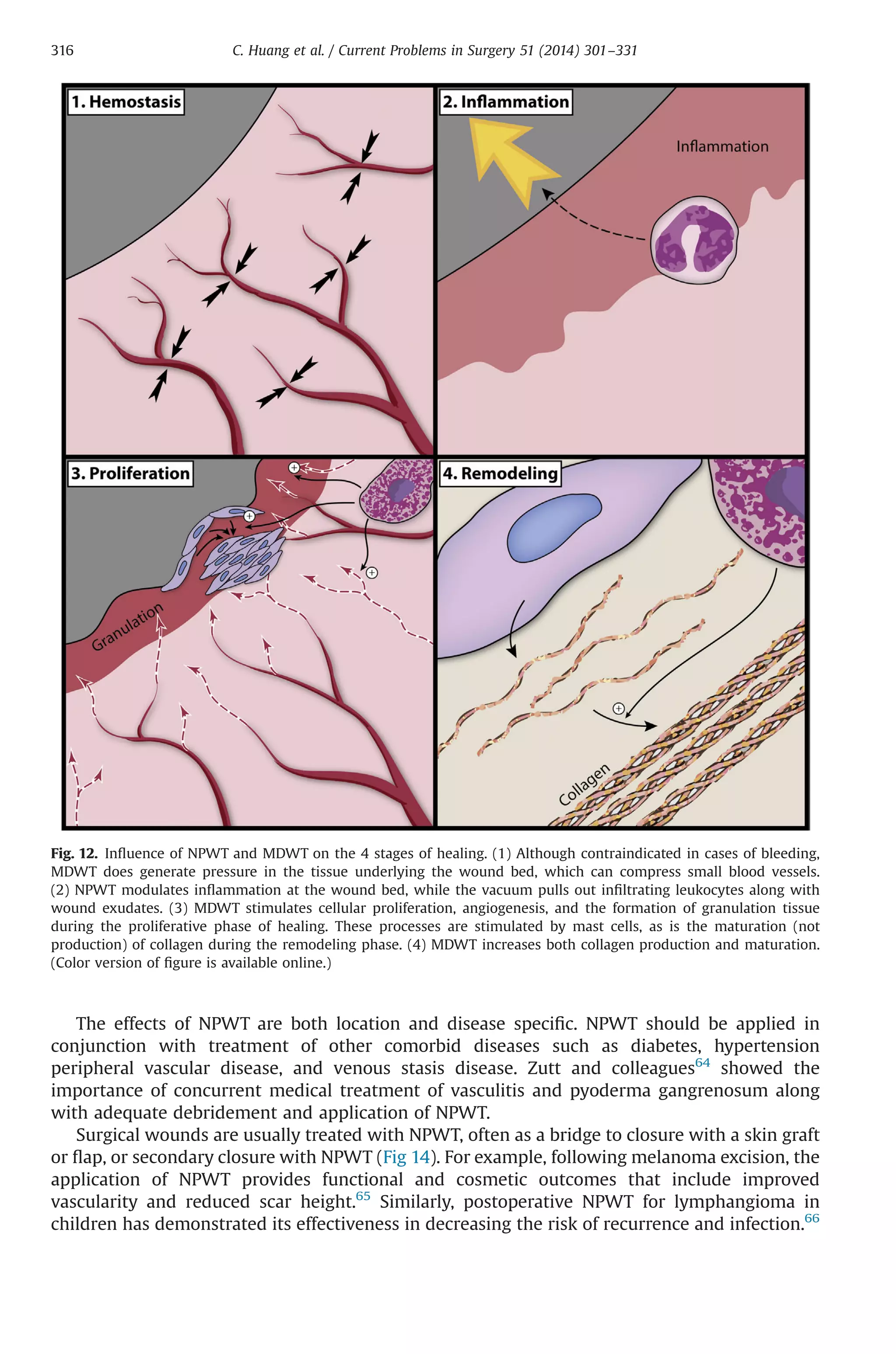 effect of negative pressure wound therapy on wound healing | PDF