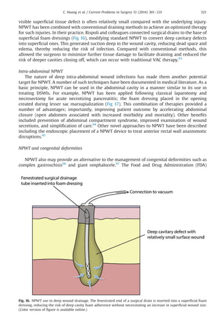 effect of negative pressure wound therapy on wound healing | PDF