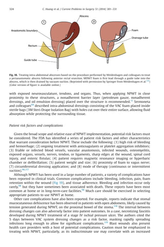 effect of negative pressure wound therapy on wound healing | PDF