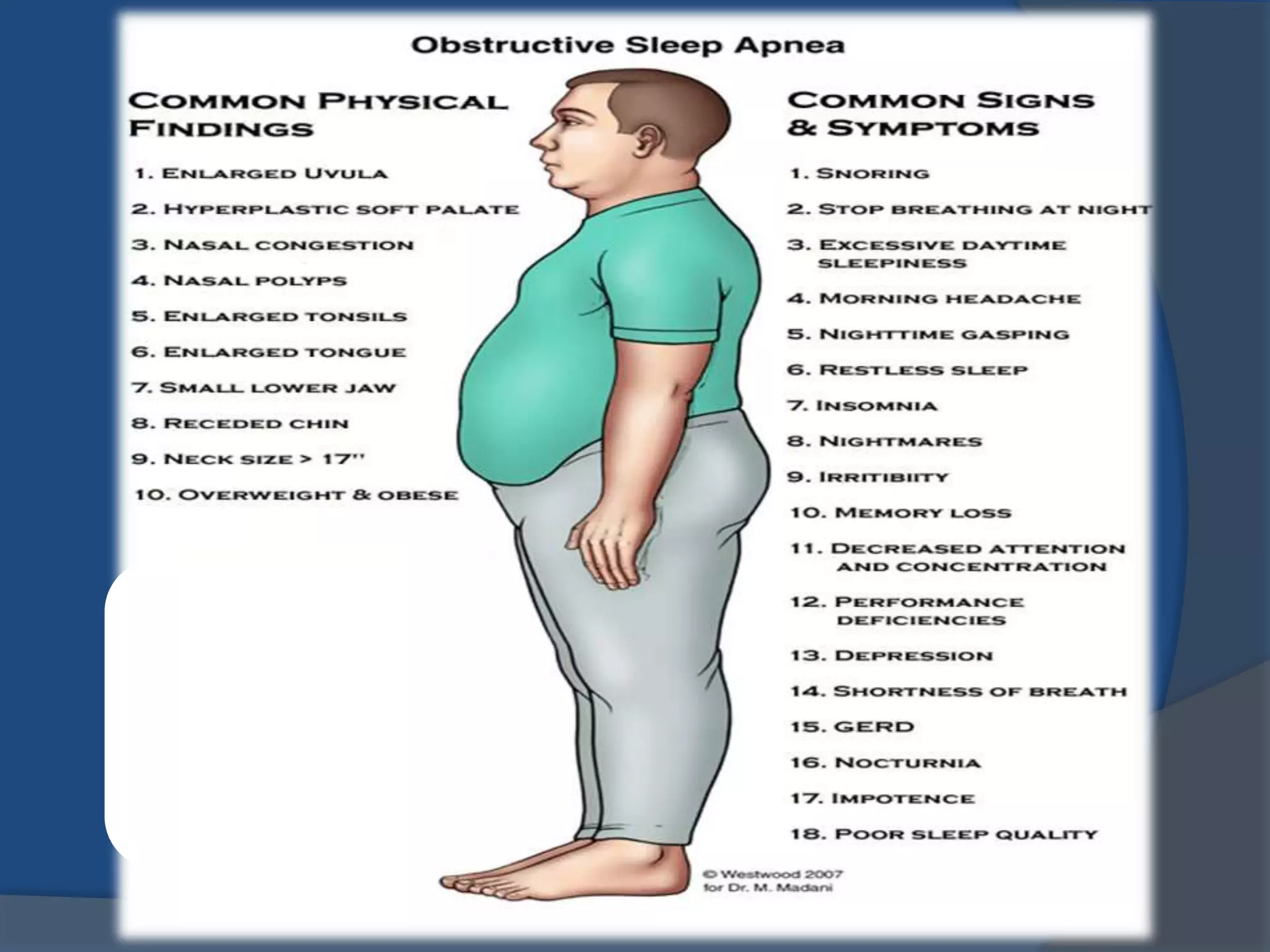 OBSTRUCTIVE SLEEP APNEA | PPTX | Ear, Nose and Throat Conditions ...
