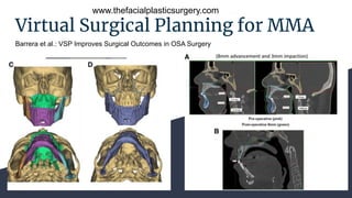 OBSTRUCTIVE SLEEP APNOEA TREATMENT | PPT