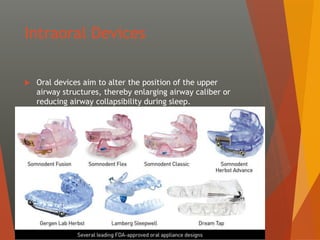 Obstructive Sleep Apnea | PPT
