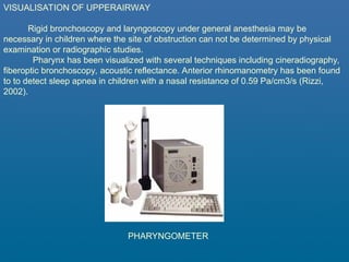 Obstructive sleep apnea in orthodontics treatment | PPT