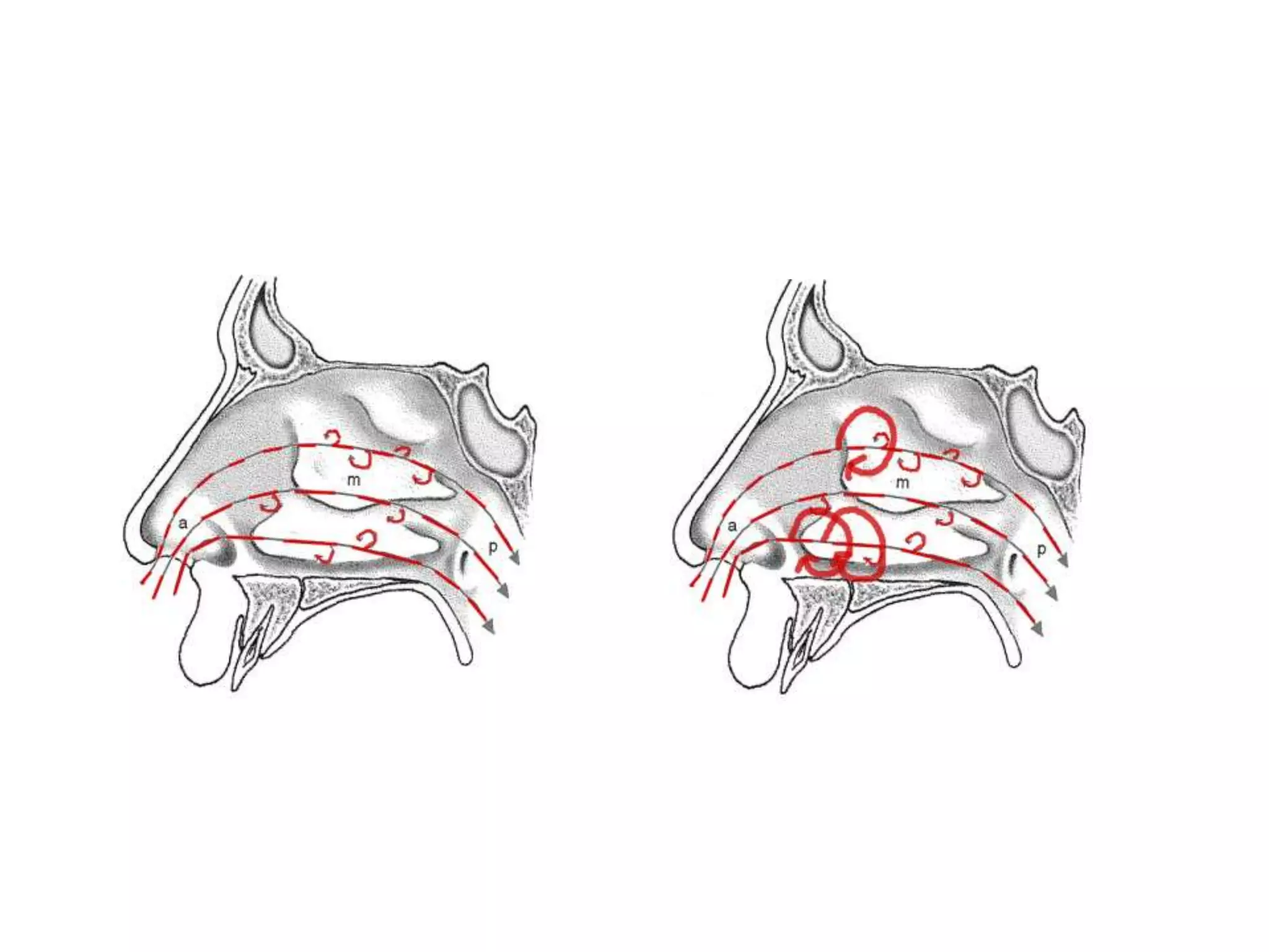 Obstructive Sleep Apnoea Pptx