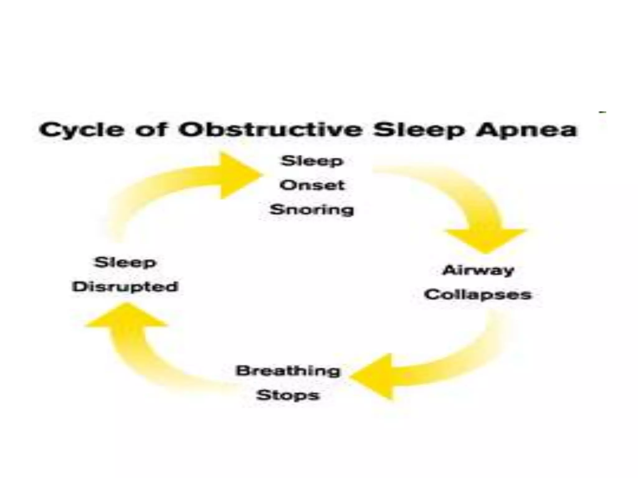 Obstructive Sleep Apnoea Pptx 0535