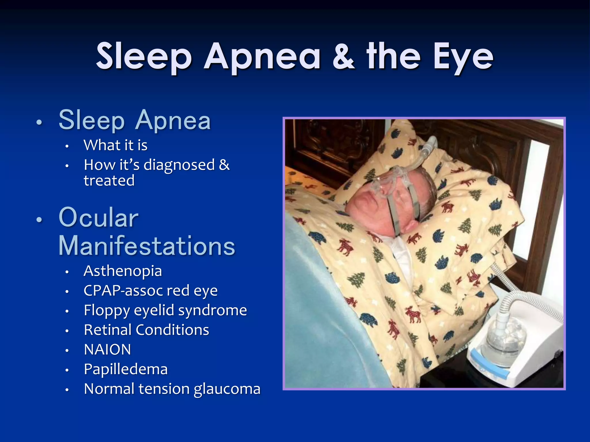 Sleep Apnea & The Eye 2015 | PPTX