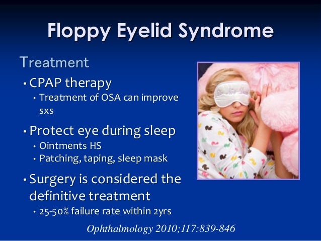 Sleep Apnea & The Eye 2015