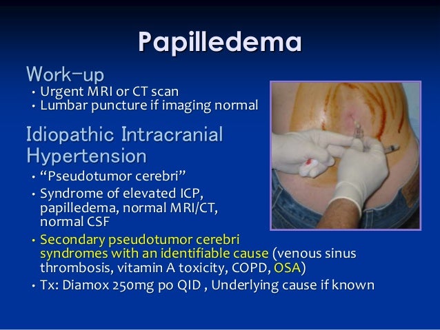 Sleep Apnea & The Eye 2015