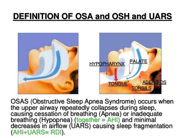 Obstructive Sleep Apnea (OSA) and Upper Airways Resistance Syndrome
