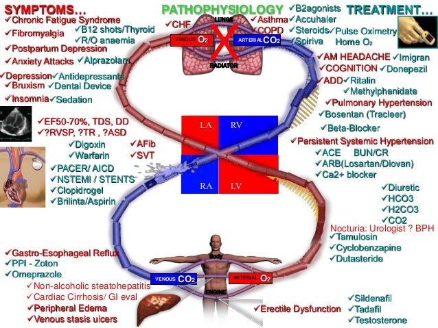 Obstructive Sleep Apnea (OSA) and Upper Airways Resistance Syndrome