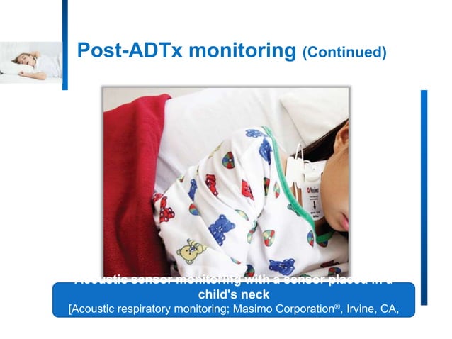 Perioperative considerations for OSA in Children | PPT
