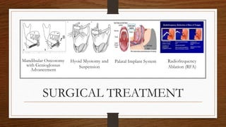 OSA (Obstructive Sleep Apnea) | PPT