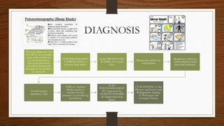 OSA (Obstructive Sleep Apnea) | PPT