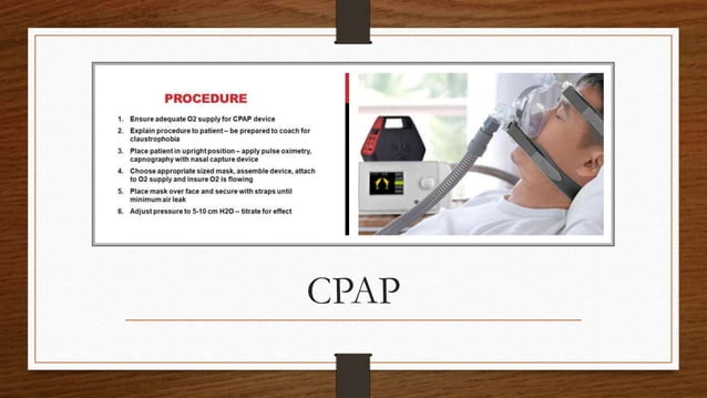 OSA (Obstructive Sleep Apnea) | PPT