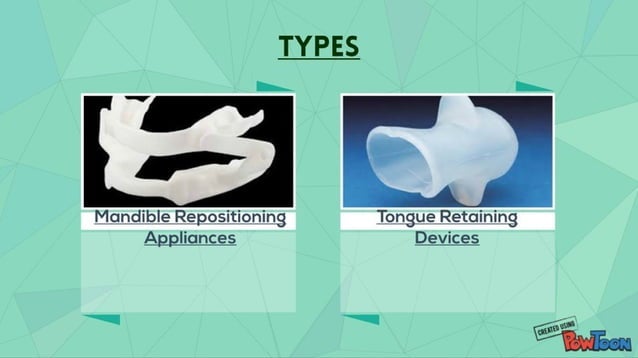 Mandibular Repositioning Appliances in Treating Obstructive Sleep Apnea ...