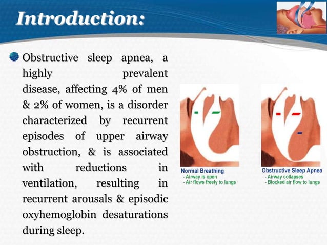 OSA is a systemic disease | PPT