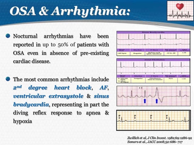 OSA is a systemic disease