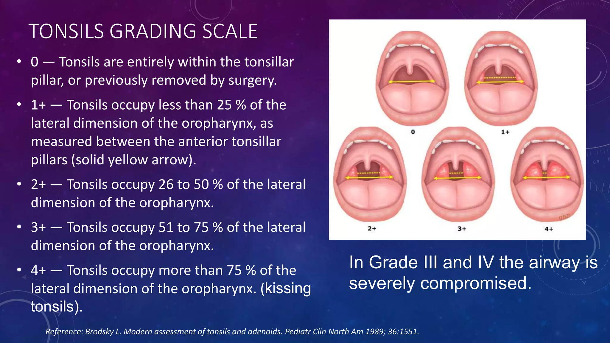 Obstructive sleep apnea- Orthodontist's perspective | PPTX