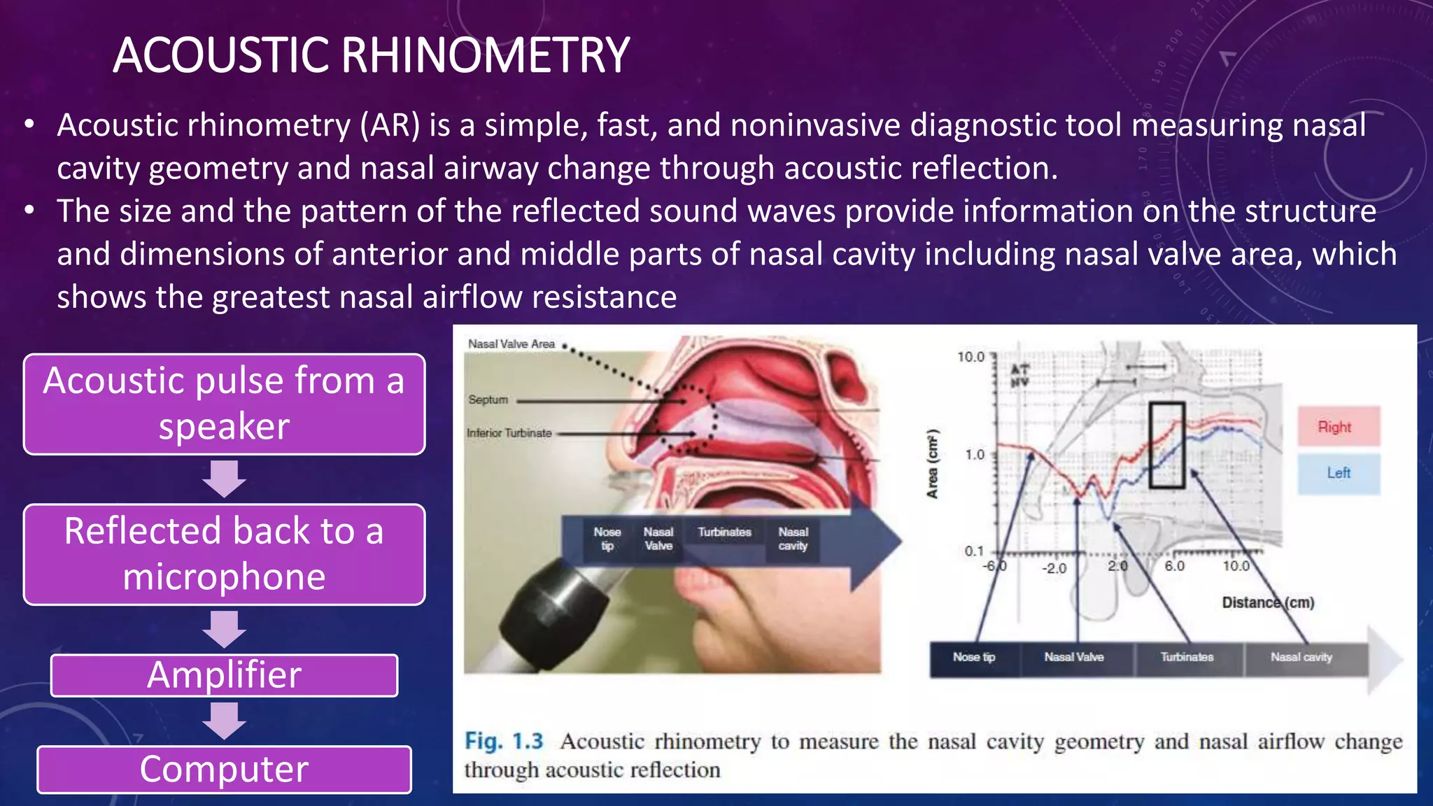 Obstructive sleep apnea- Orthodontist's perspective | PPTX