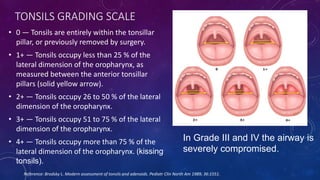 Obstructive sleep apnea- Orthodontist's perspective | PPTX