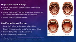 Obstructive sleep apnea- Orthodontist's perspective | PPTX