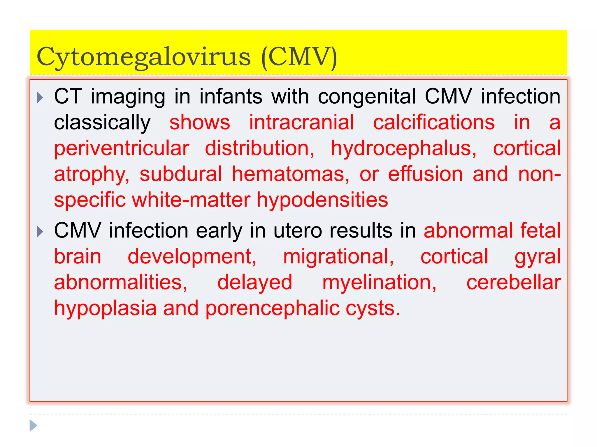 imaging of viral encephalitis | PPTX