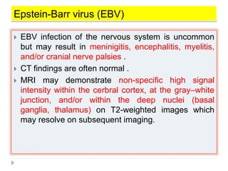 imaging of viral encephalitis | PPTX