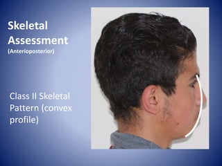 Osama ziadat case presentation | PPTX