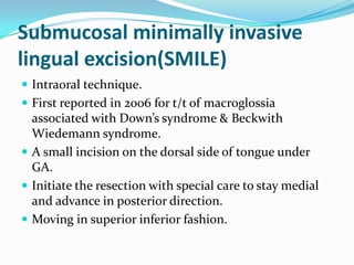 Osas tongue surgery | PPT