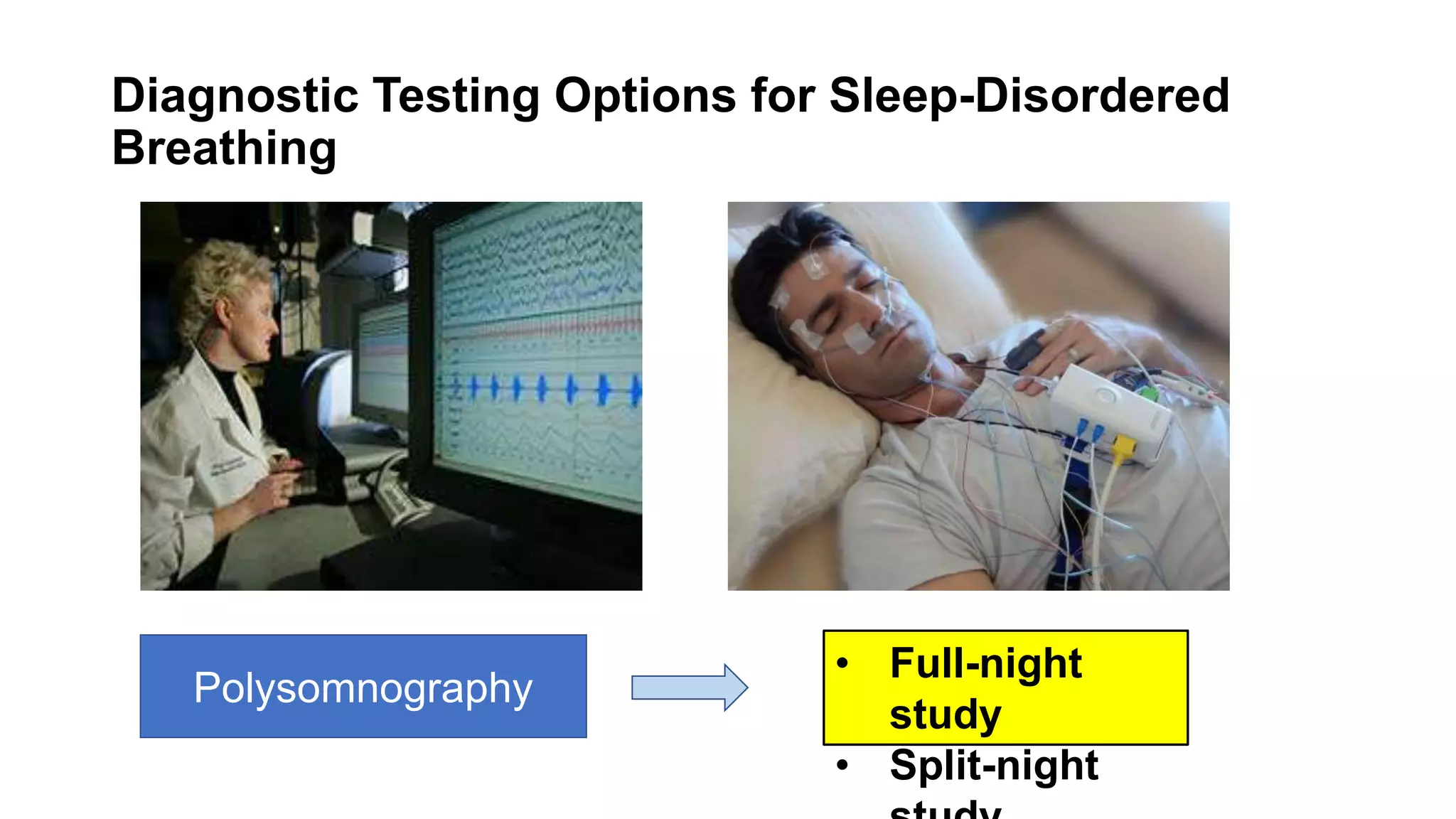 Obstructive sleep apnea | PPTX