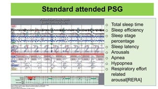 Obstructive sleep apnea | PPT