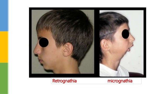 Osa topic presentation