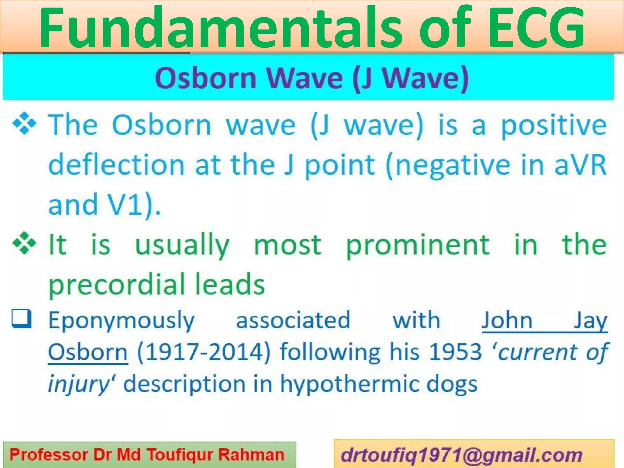 Osborne wave(J wave) and j point in ECG | PPSX | Heart and ...