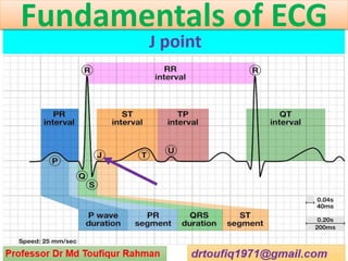 Osborne wave(J wave) and j point in ECG | PPSX | Heart and ...