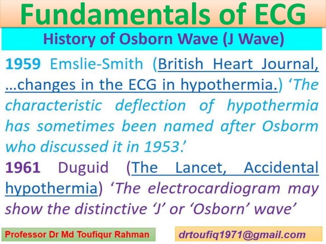 Osborne wave(J wave) and j point in ECG | PPSX | Heart and ...