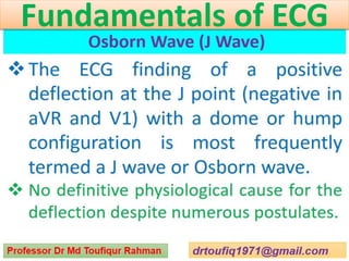 Osborne wave(J wave) and j point in ECG | PPSX | Heart and ...