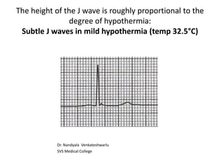 Osborn wave venkat ppt | PPT