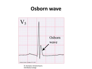 Osborn wave venkat ppt | PPT