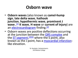 Osborn wave venkat ppt | PPT