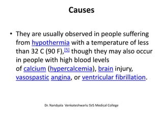 Osborn wave venkat ppt | PPT
