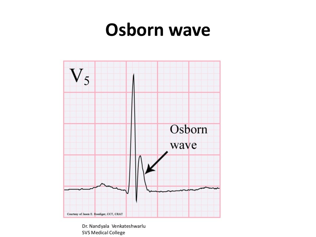 Osborn wave venkat ppt