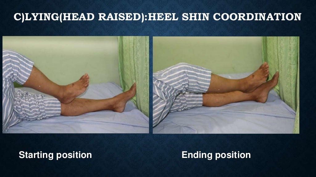 Frenkel's Exercise (Bangladesh Health Profession Institute) CRP