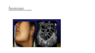 OSCE questions in obstetrics and gynaecology for final year | PPTX