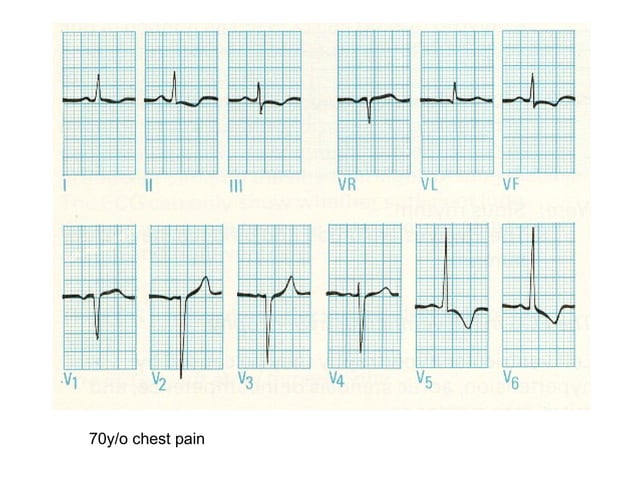 Osce ecg | PPT | Heart and Cardiovascular Diseases | Diseases and ...