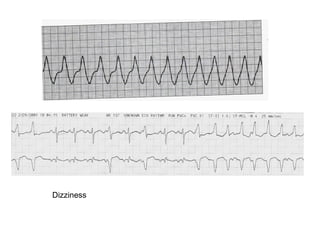 Osce ecg | PPT