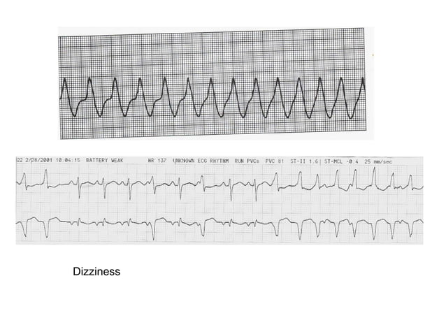 Osce ecg | PPT | Heart and Cardiovascular Diseases | Diseases and ...