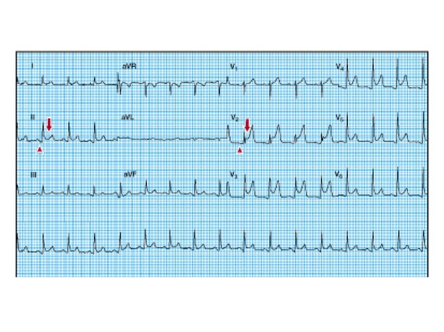 Osce ecg | PPT | Heart and Cardiovascular Diseases | Diseases and ...
